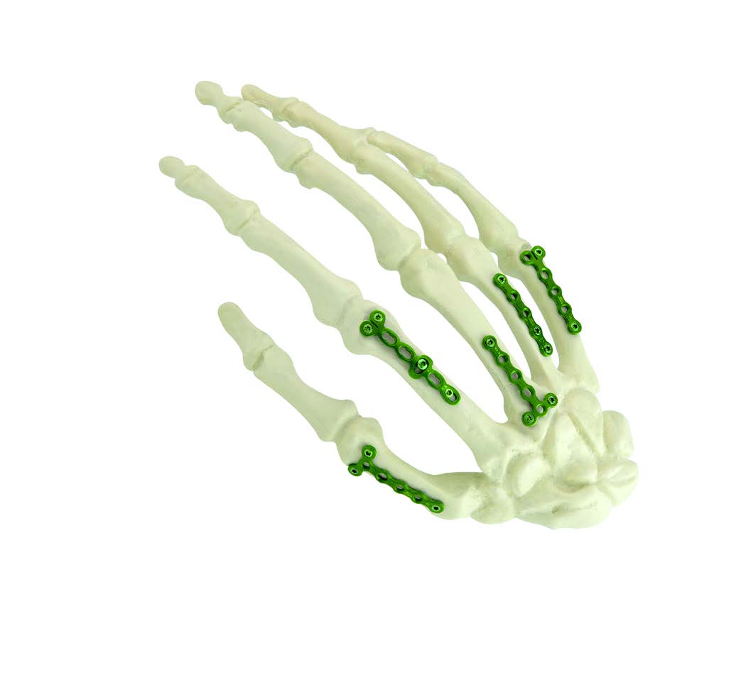 Hand | Equinox Medical