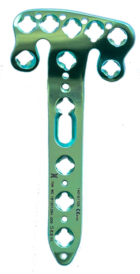 Distal Radius.png-1 | Equinox Medical